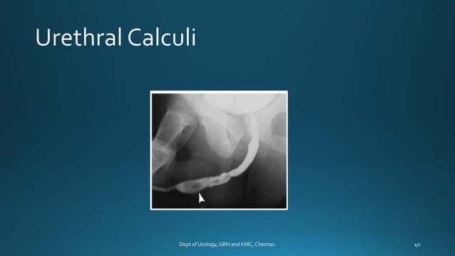 ANTEGRADE URETHROGRAM | PDF