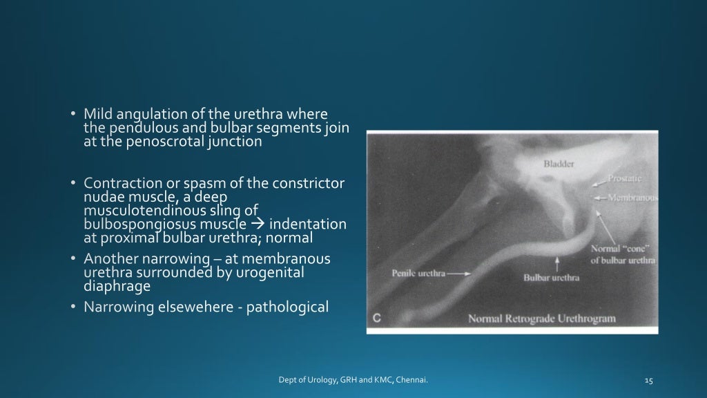 ANTEGRADE URETHROGRAM