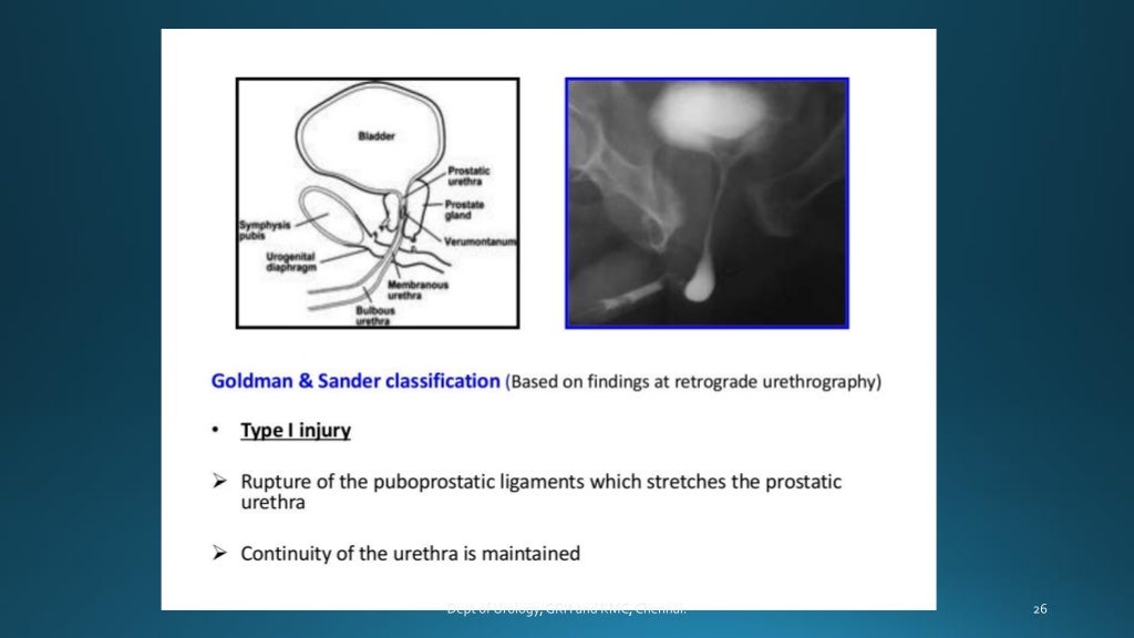 ANTEGRADE URETHROGRAM
