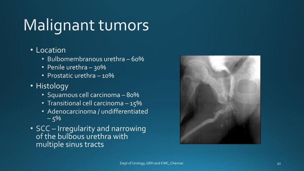 ANTEGRADE URETHROGRAM
