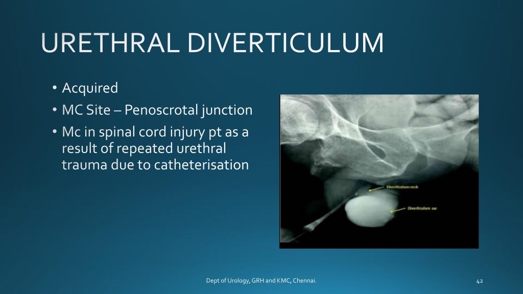ANTEGRADE URETHROGRAM