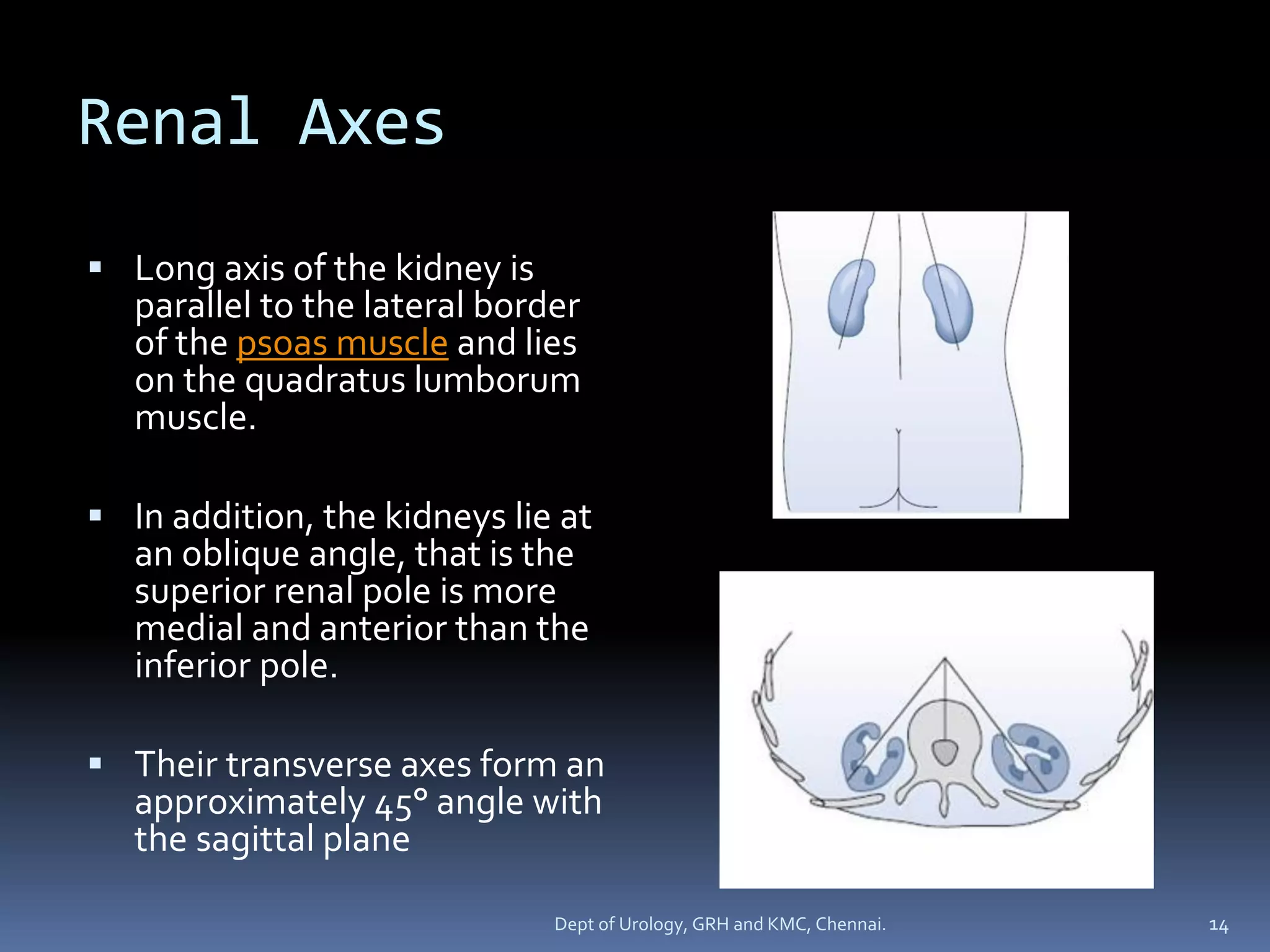 INTRAVENOUS UROGRAPHY 1 | PDF