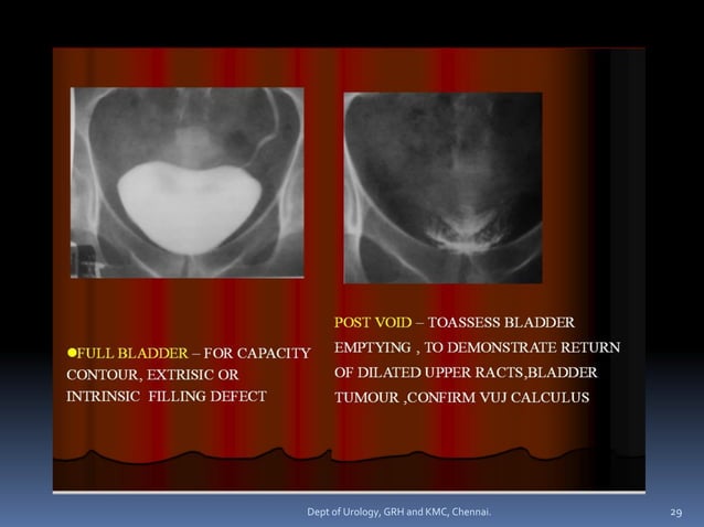 INTRAVENOUS UROGRAPHY 1 | PPT