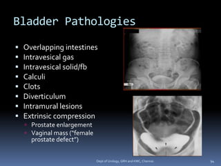 INTRAVENOUS UROGRAPHY 1 | PDF