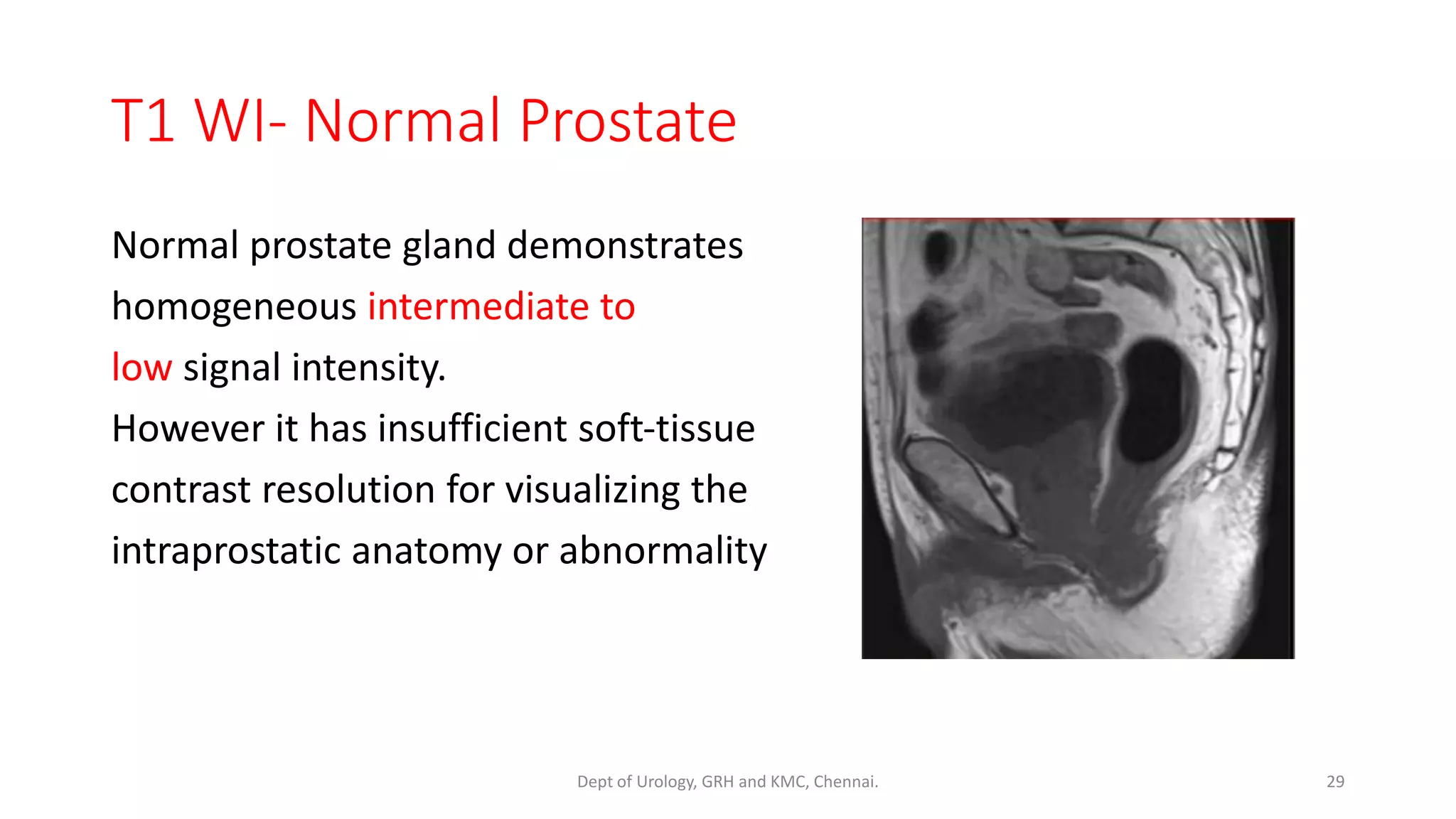 MRI IN UROLOGY | PDF