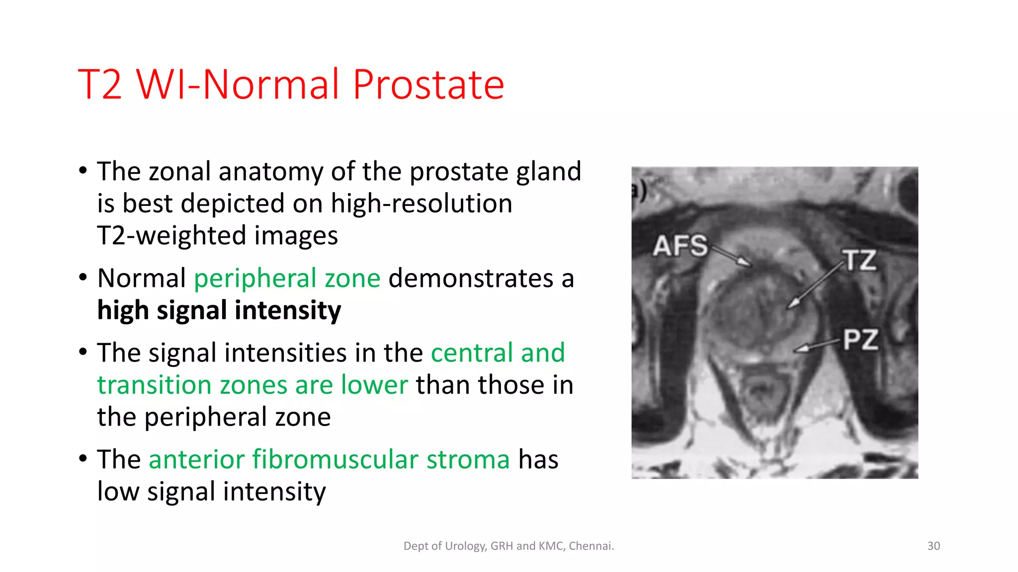 MRI IN UROLOGY | PDF