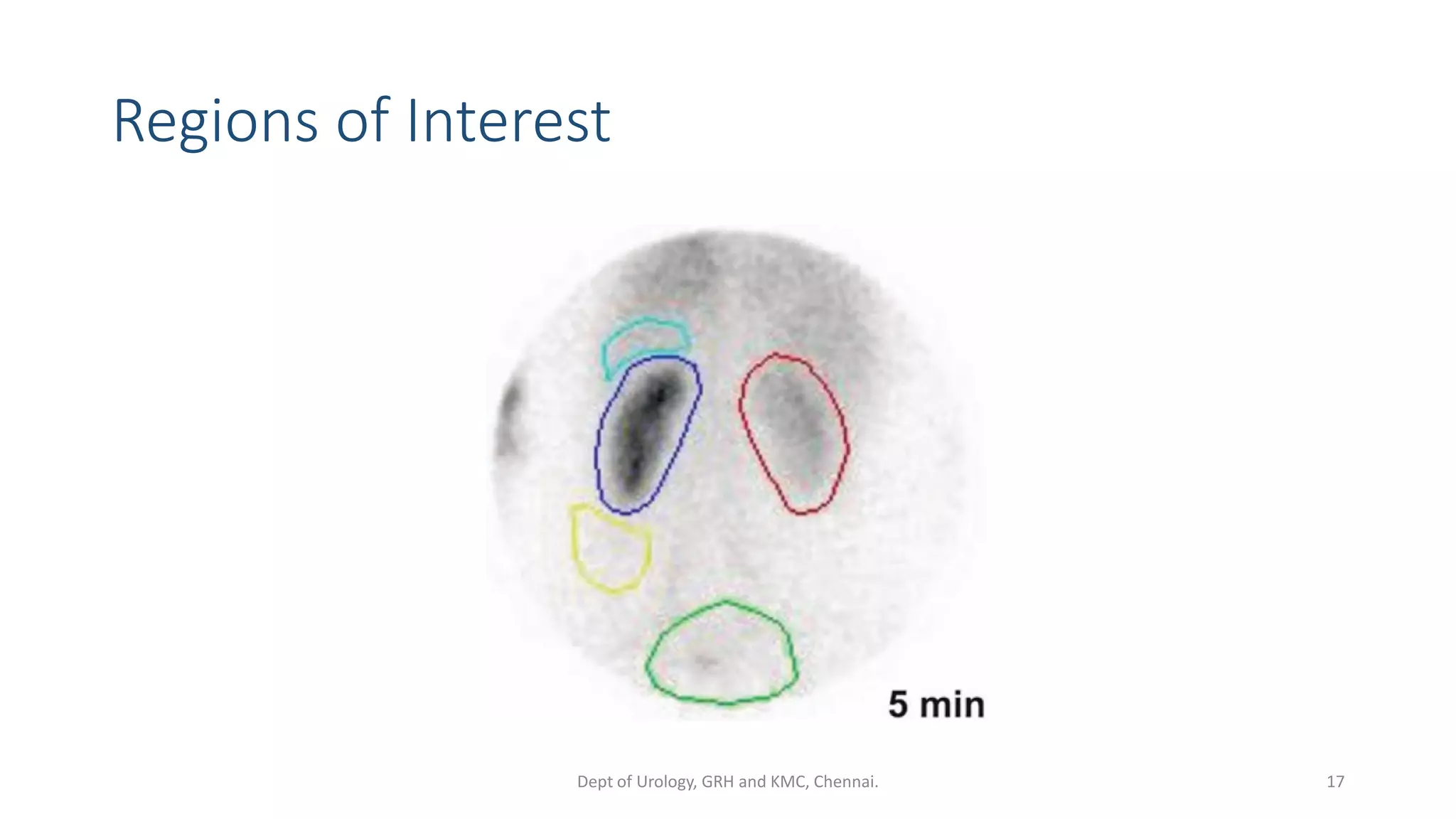 RENOGRAM | PDF | Blood Disorders | Diseases and Conditions