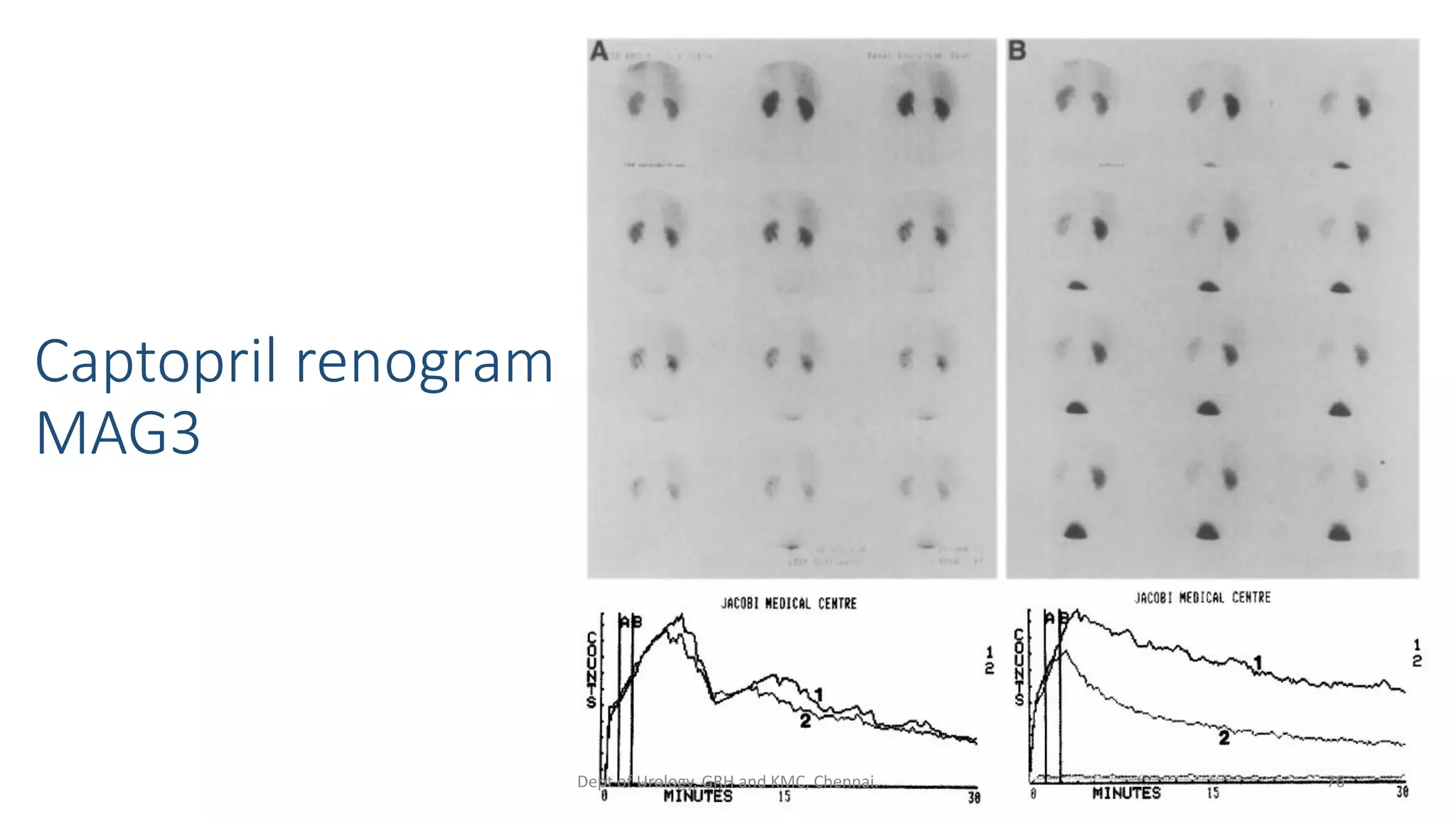 RENOGRAM | PDF