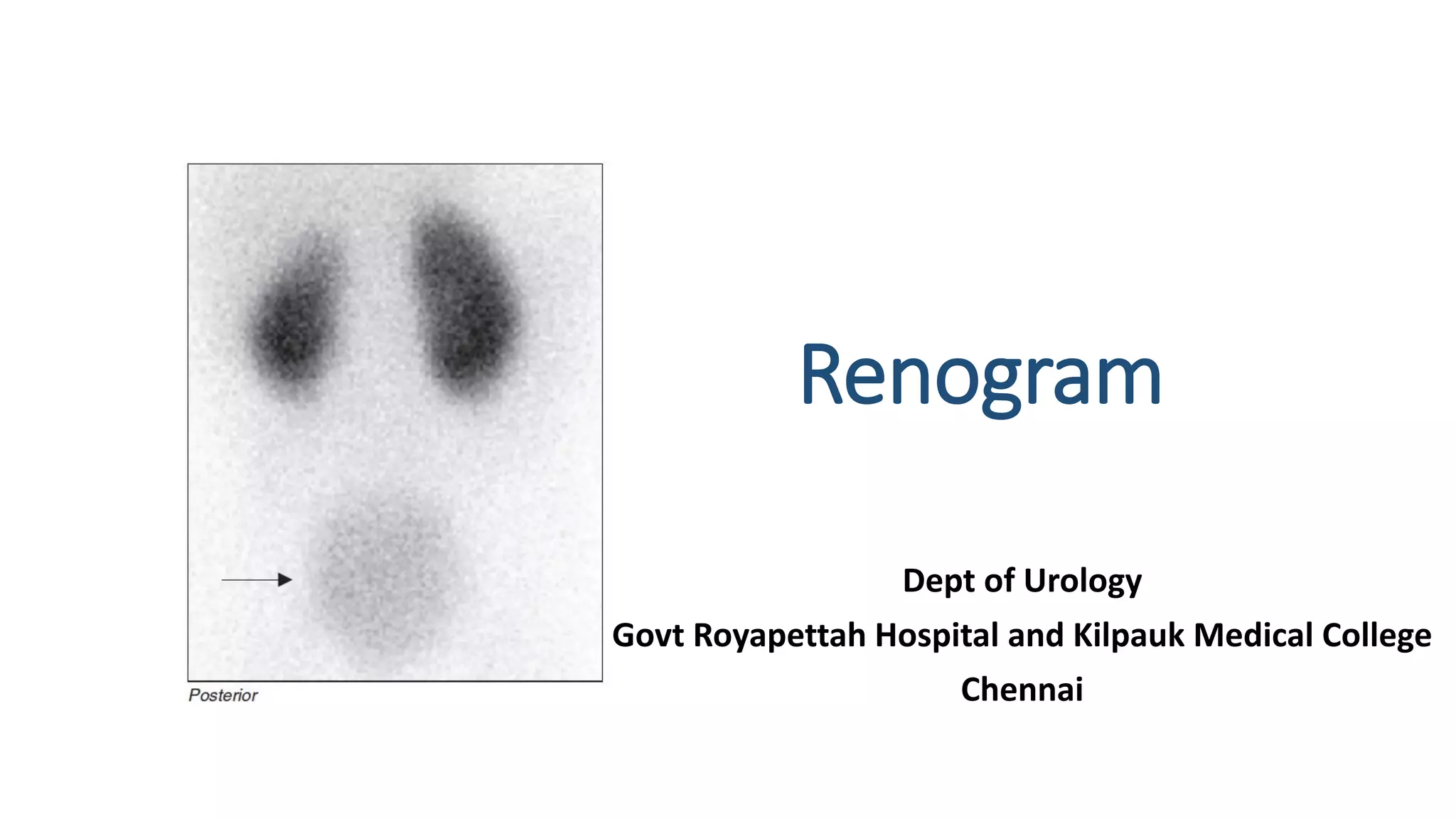 RENOGRAM | PPT