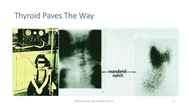 RENOGRAM | PDF | Blood Disorders | Diseases and Conditions