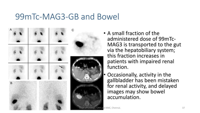 RENOGRAM | PDF | Blood Disorders | Diseases and Conditions