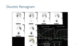 RENOGRAM | PDF