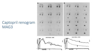RENOGRAM | PDF