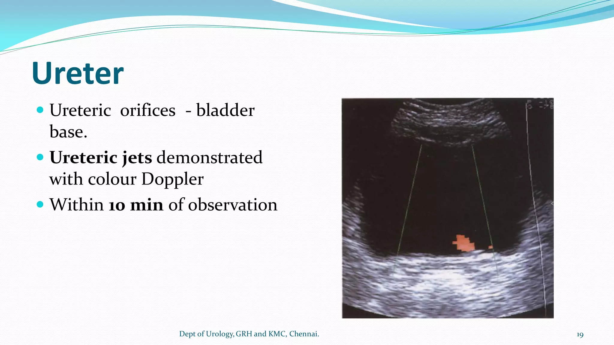ULTRASOUND IN UROLOGY | PDF