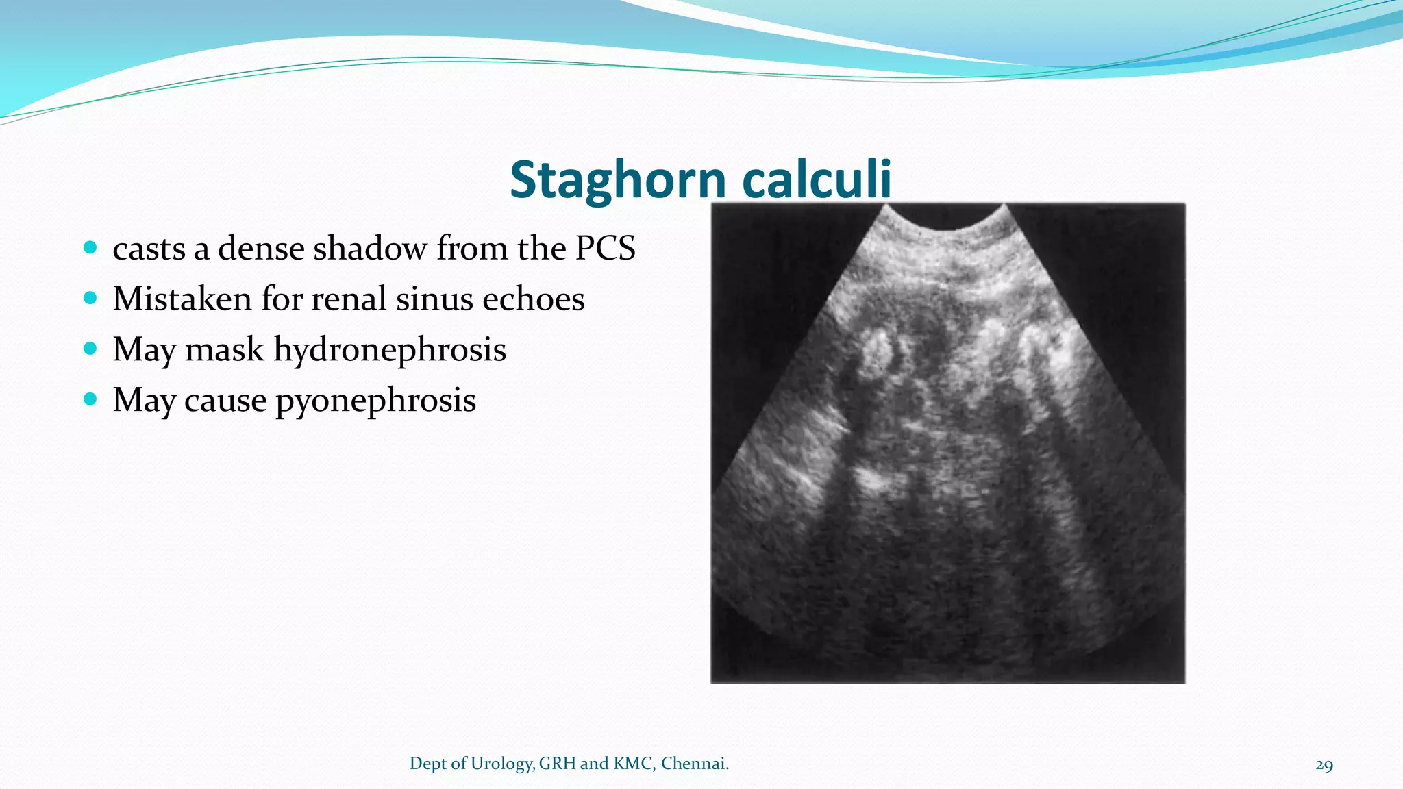 ULTRASOUND IN UROLOGY | PDF