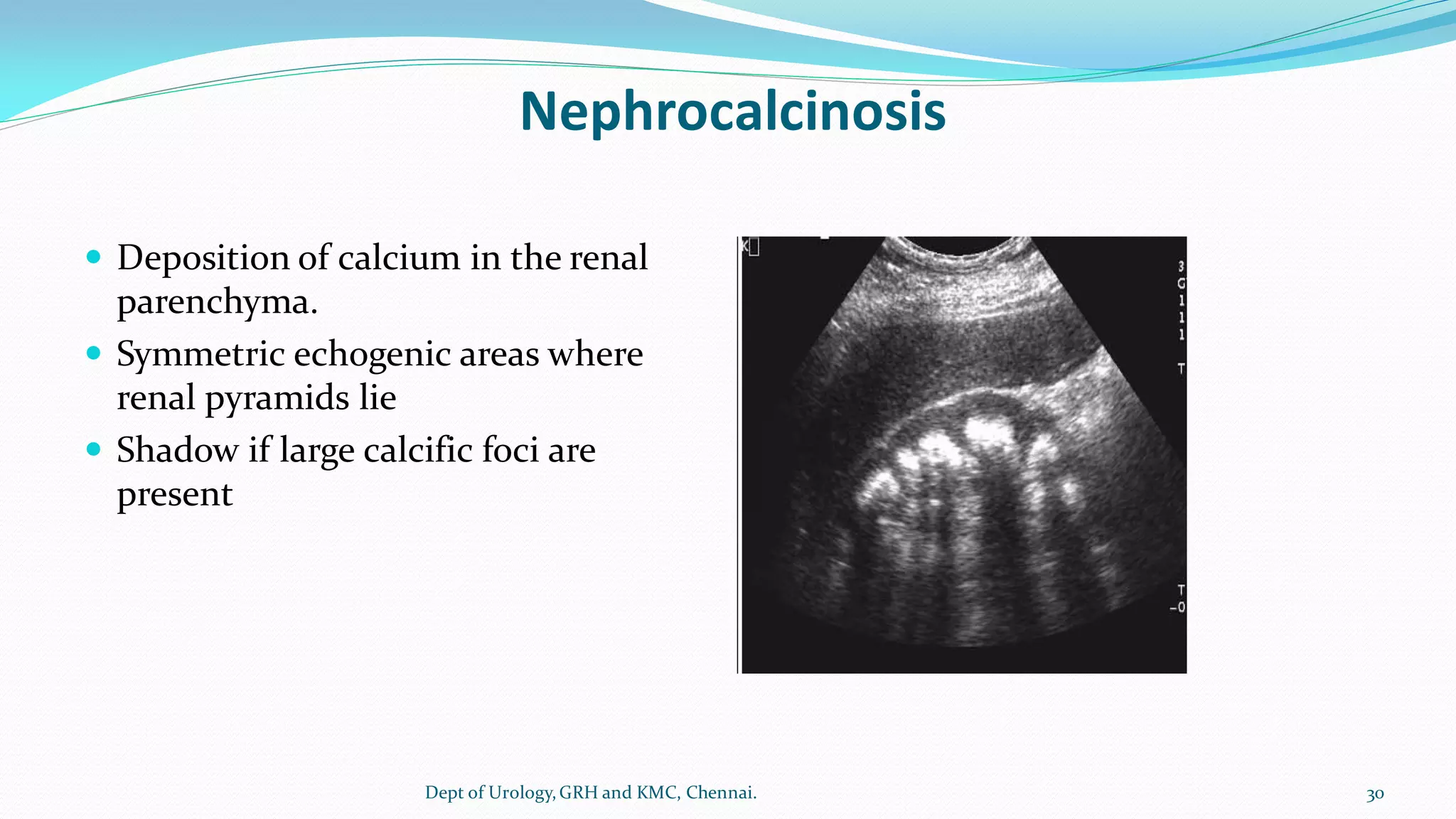 ULTRASOUND IN UROLOGY | PDF
