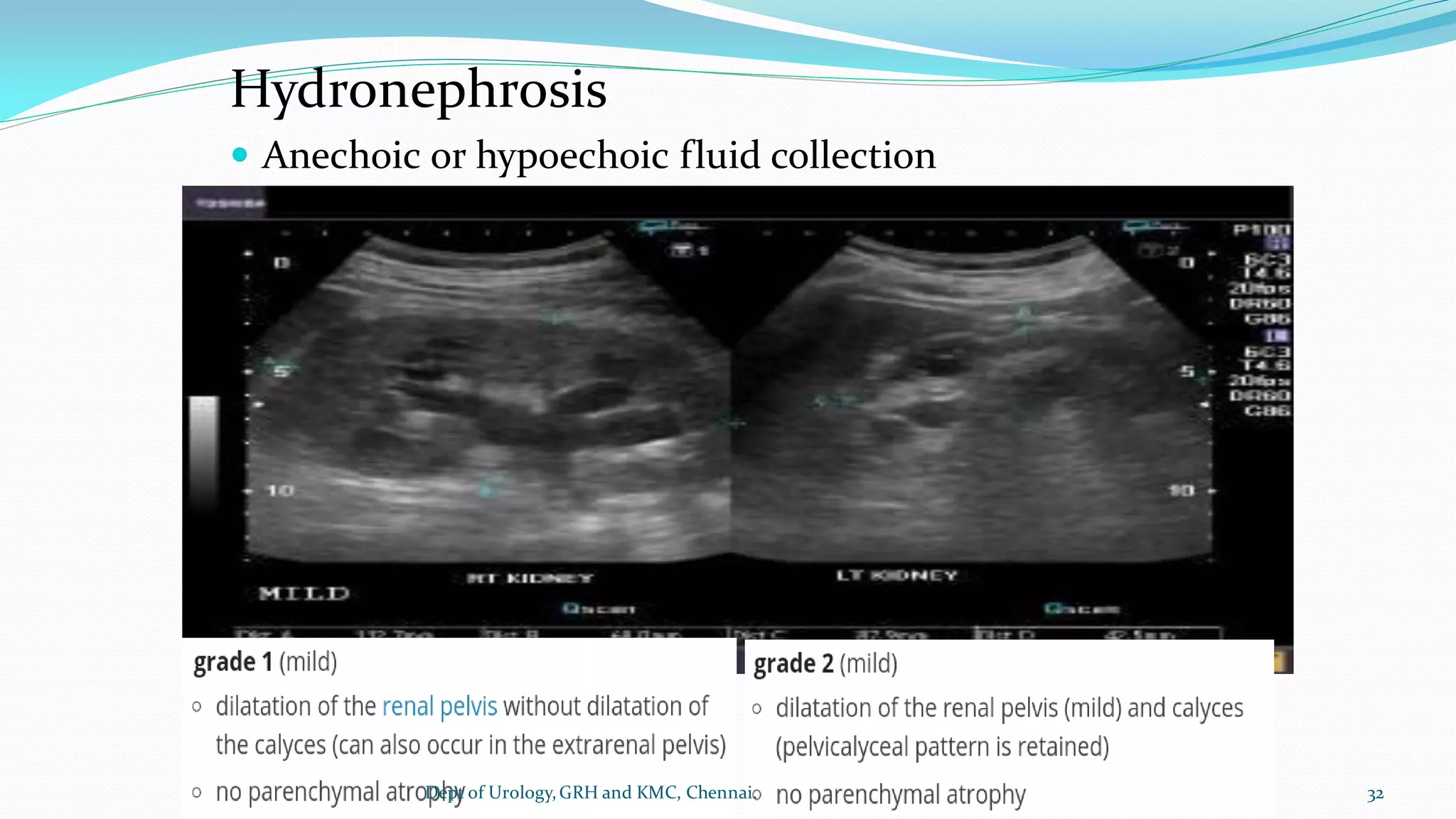 ULTRASOUND IN UROLOGY | PDF