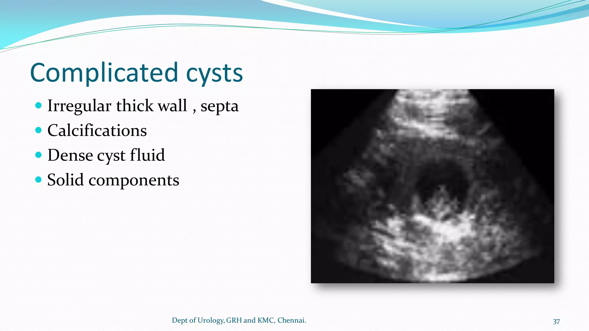 ULTRASOUND IN UROLOGY | PDF