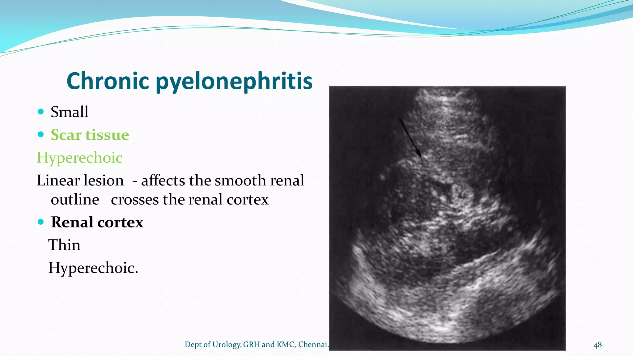 ULTRASOUND IN UROLOGY | PDF