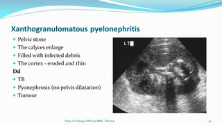 ULTRASOUND IN UROLOGY | PDF