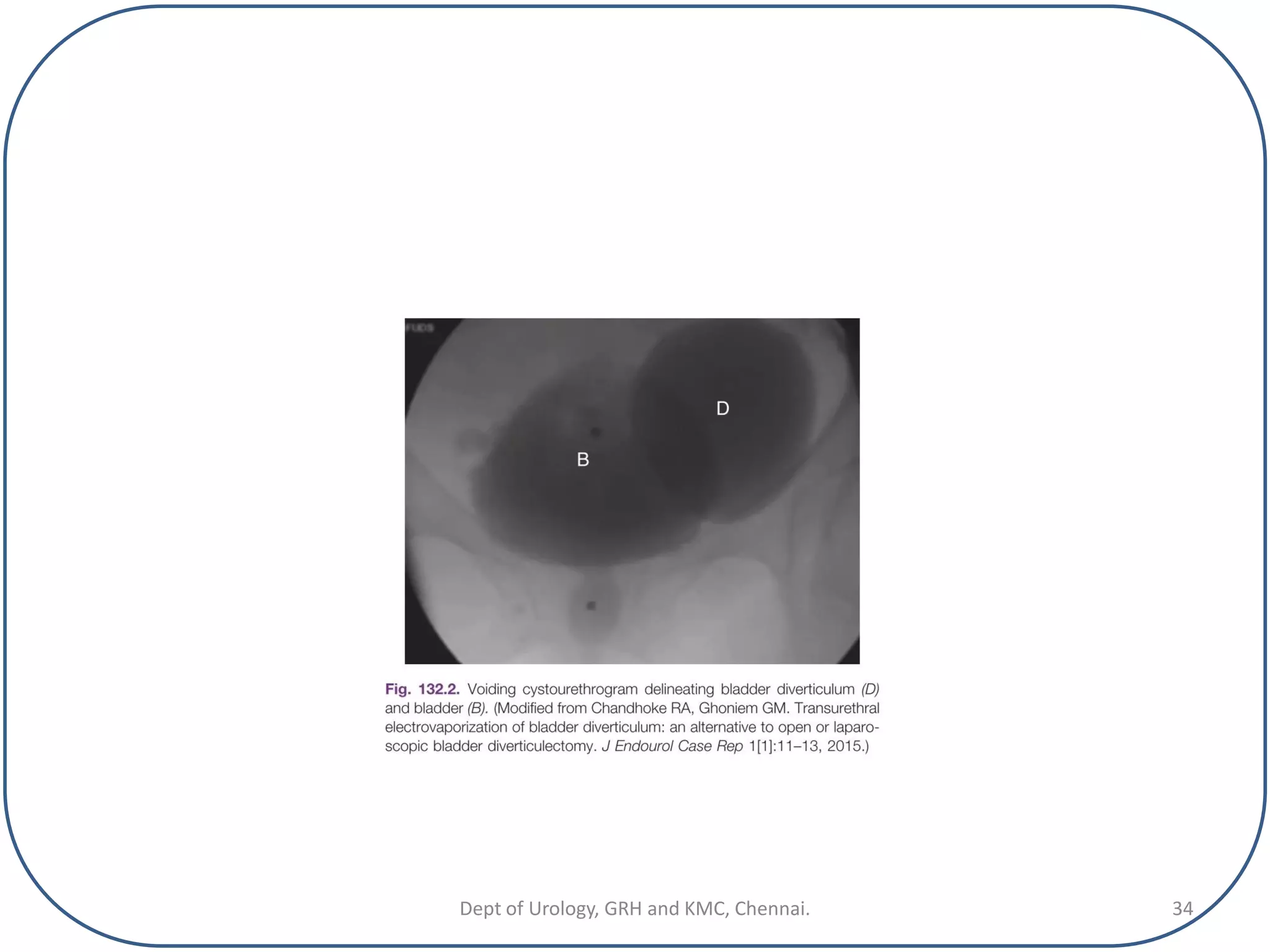 VOIDING CYSTO URETHROGRAM | PDF