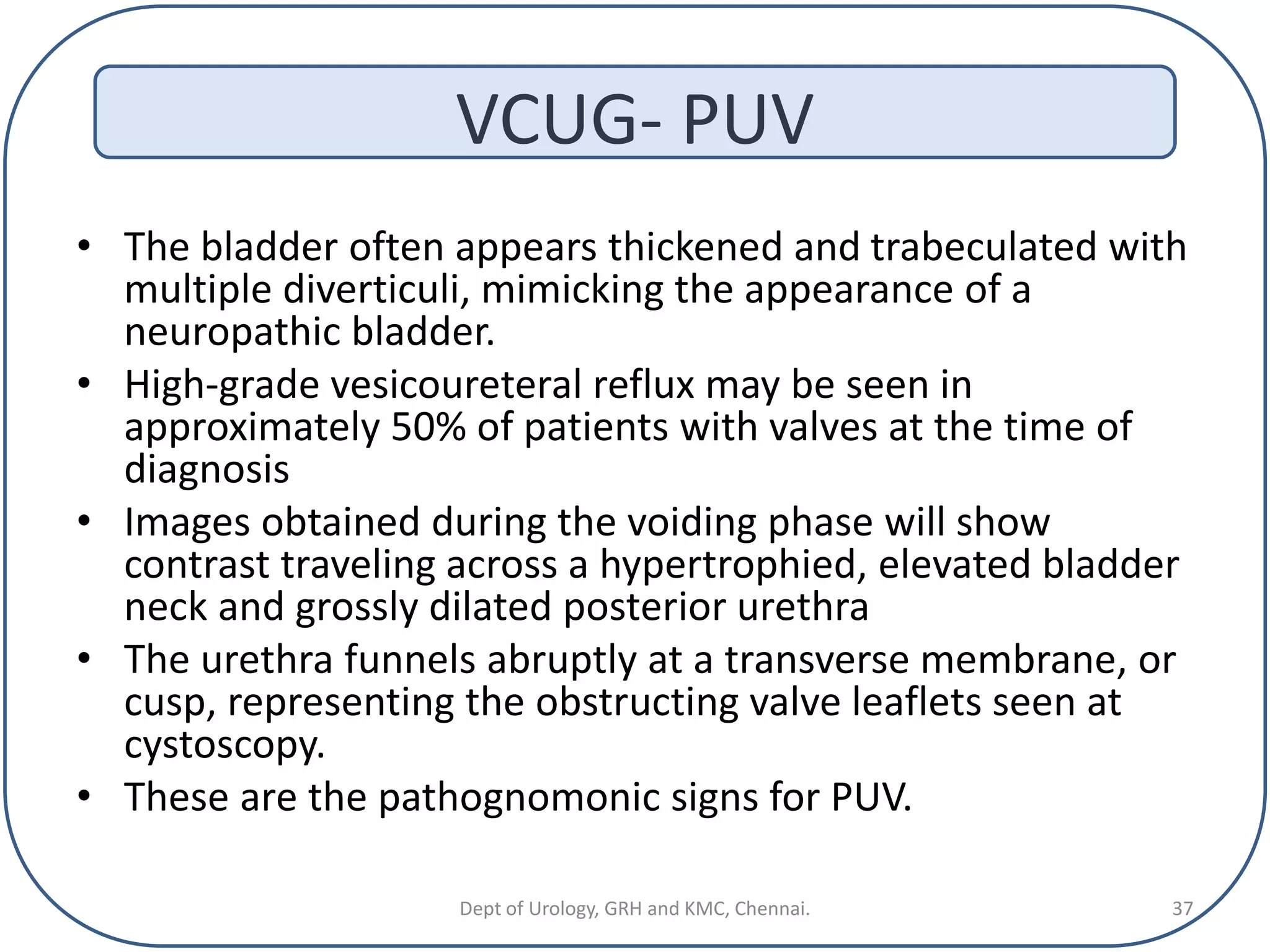 VOIDING CYSTO URETHROGRAM | PDF