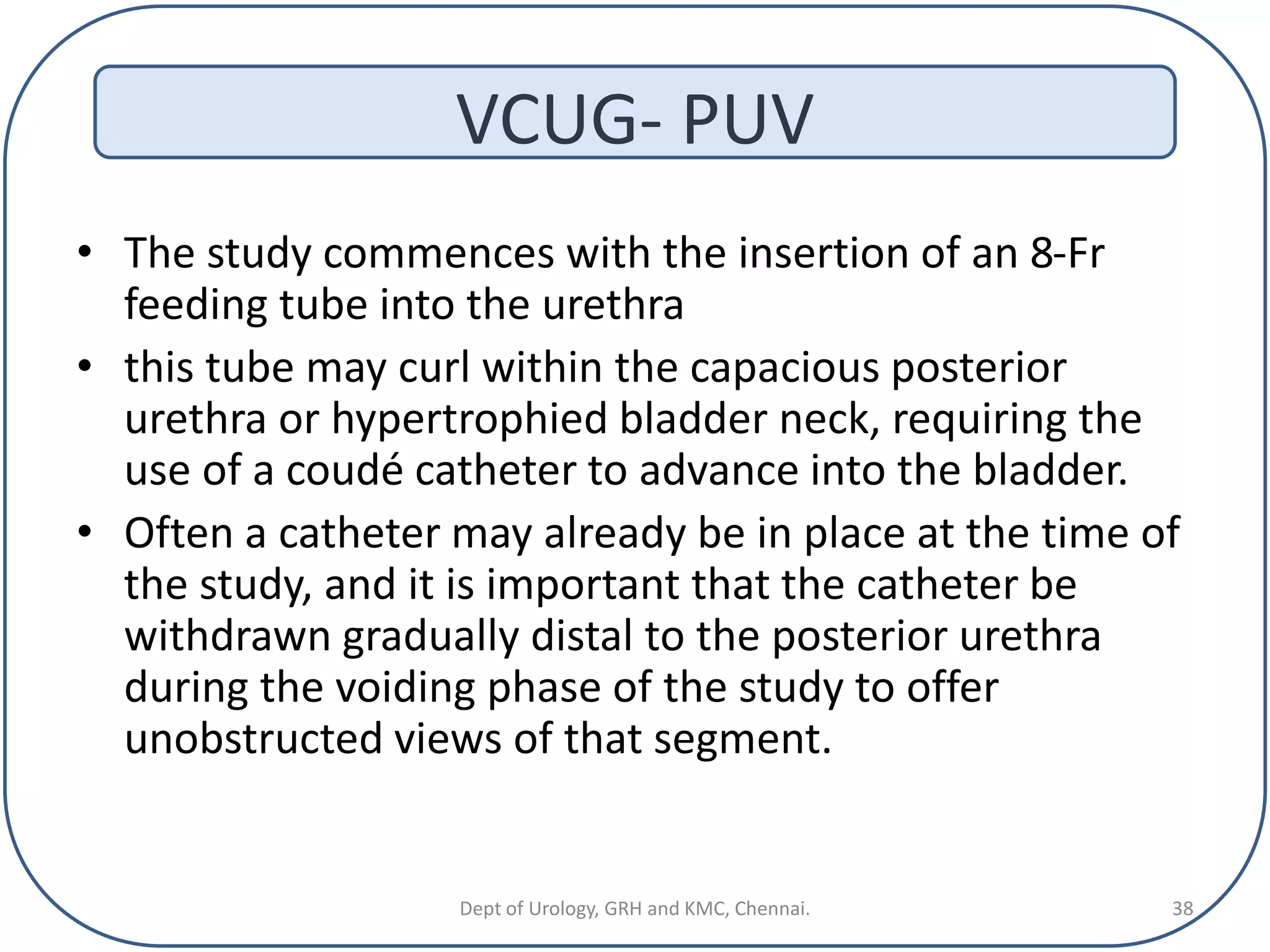 VOIDING CYSTO URETHROGRAM | PDF