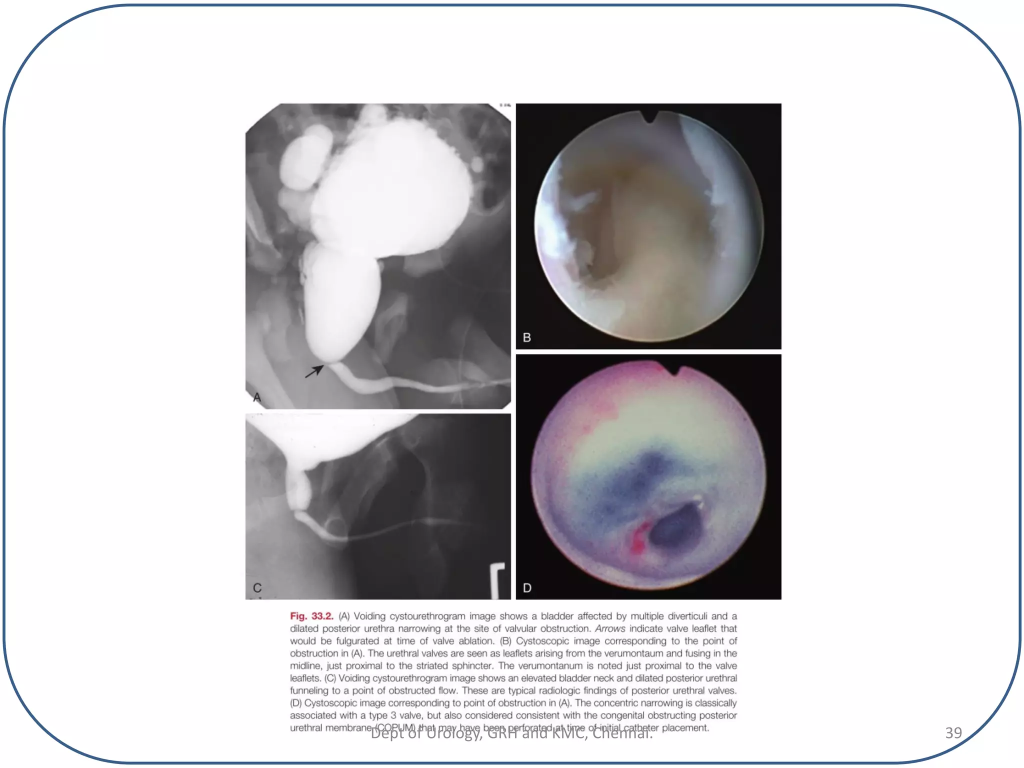 VOIDING CYSTO URETHROGRAM | PDF