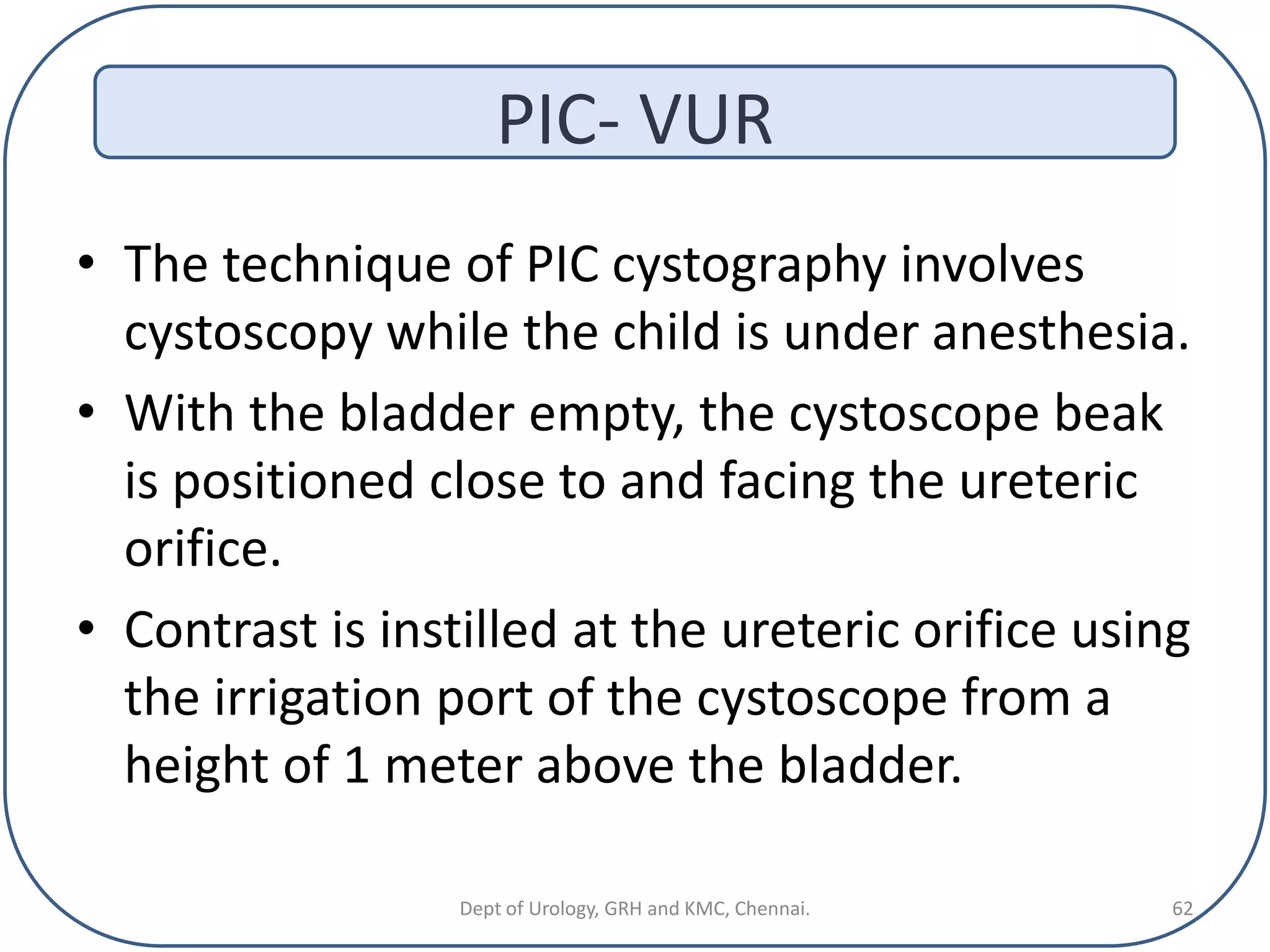VOIDING CYSTO URETHROGRAM | PDF
