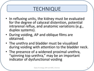 VOIDING CYSTO URETHROGRAM | PDF