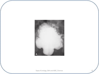 VOIDING CYSTO URETHROGRAM | PDF