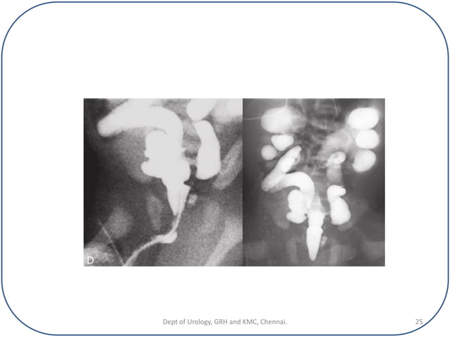 VOIDING CYSTO URETHROGRAM | PDF