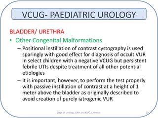VOIDING CYSTO URETHROGRAM | PDF