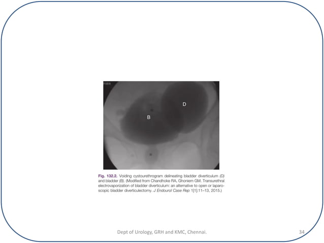 VOIDING CYSTO URETHROGRAM | PDF