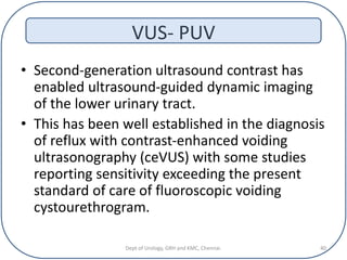 VOIDING CYSTO URETHROGRAM | PDF