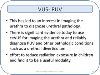 VOIDING CYSTO URETHROGRAM | PDF