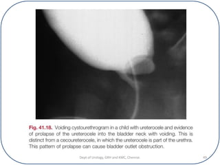 VOIDING CYSTO URETHROGRAM | PDF