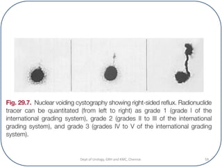 VOIDING CYSTO URETHROGRAM | PDF
