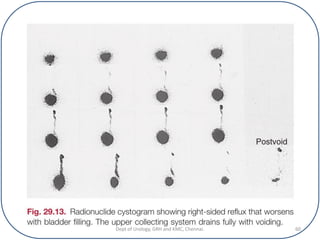 VOIDING CYSTO URETHROGRAM | PDF