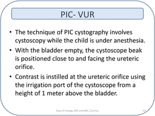 VOIDING CYSTO URETHROGRAM | PDF