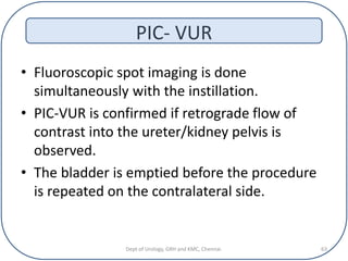 VOIDING CYSTO URETHROGRAM | PDF