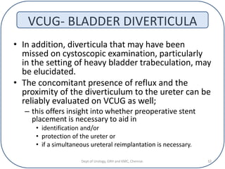 Bladder Diverticulum Vcug