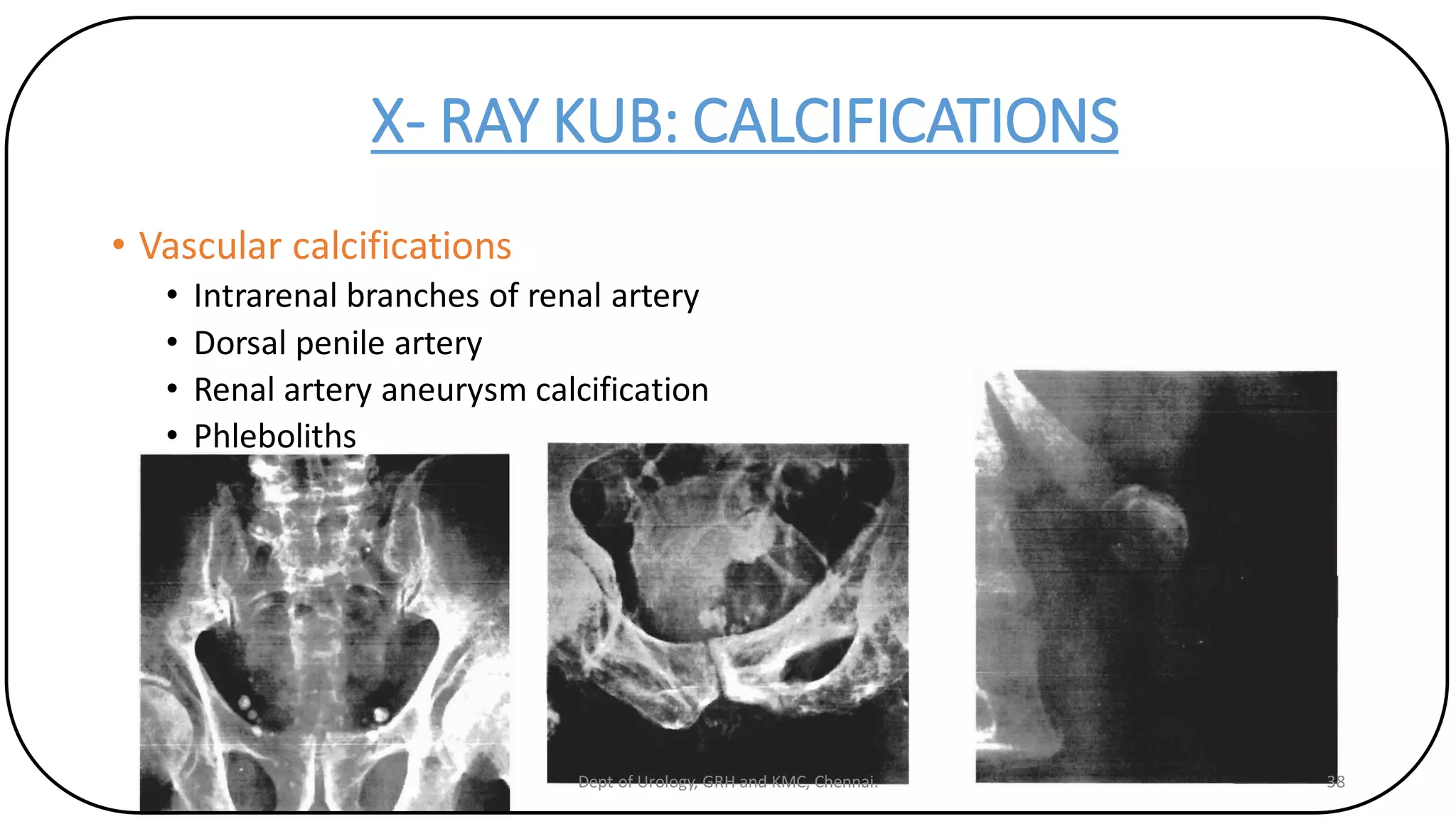 X RAY KUB 2 | PDF