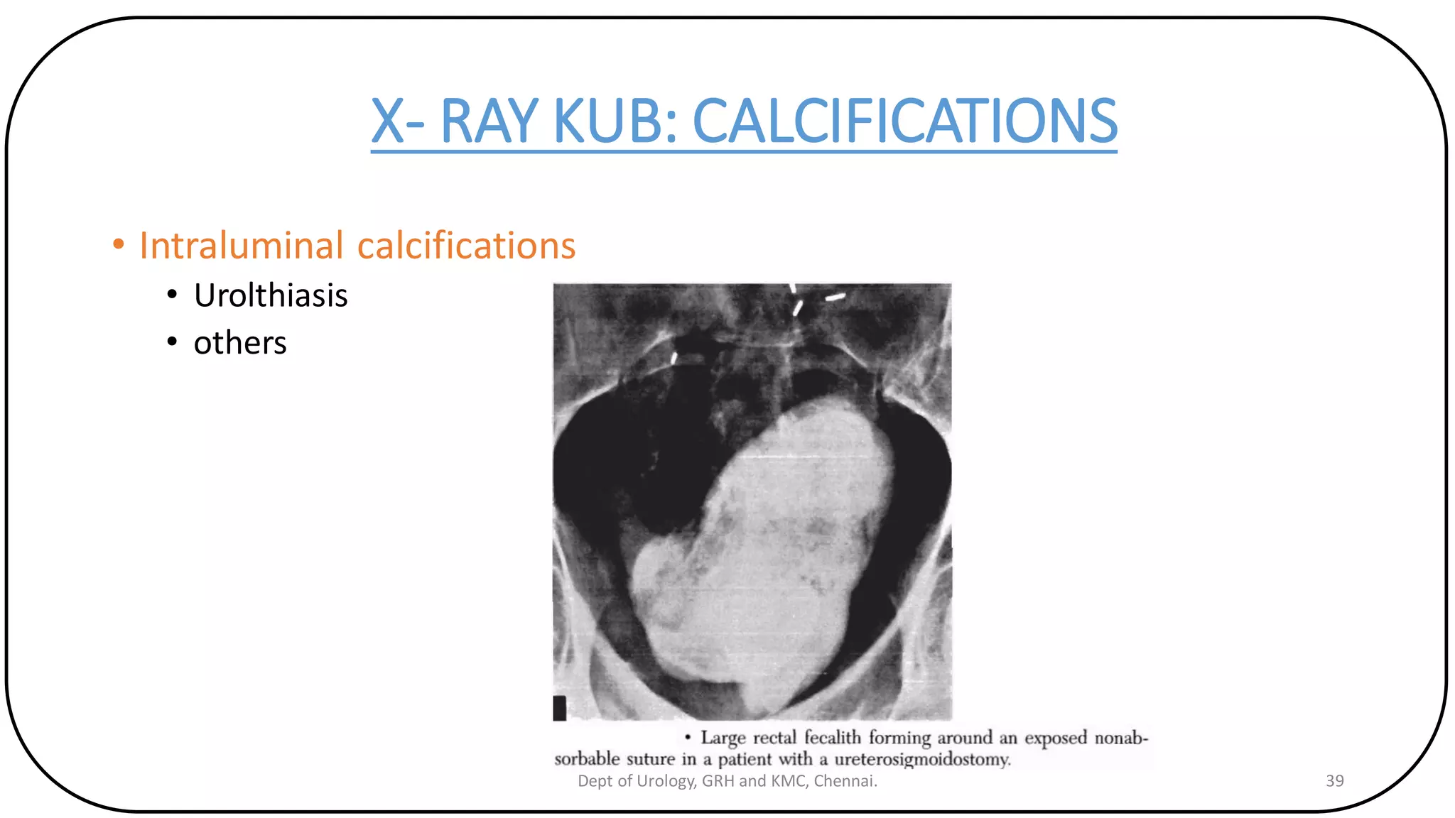 X RAY KUB 2 | PDF
