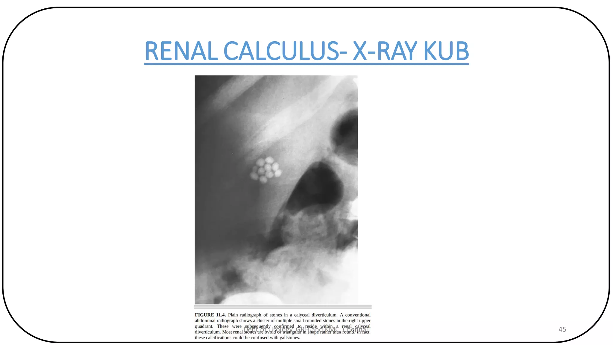 X RAY KUB 2 | PDF