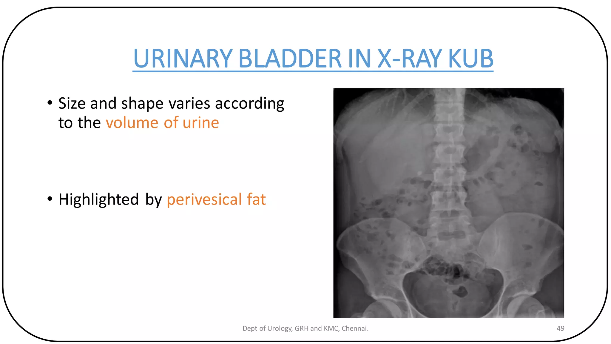 X RAY KUB 2 | PDF