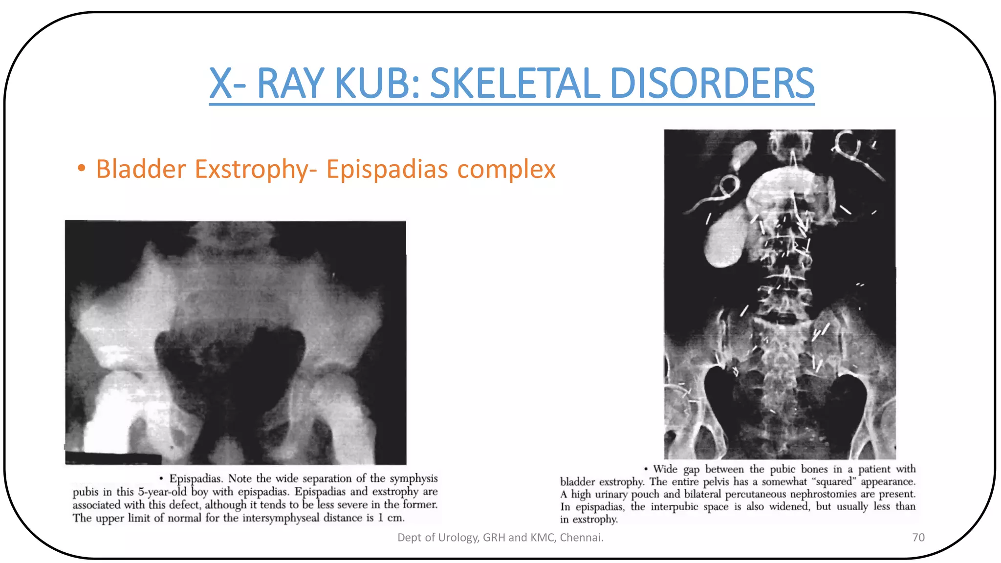 X RAY KUB 2 | PDF