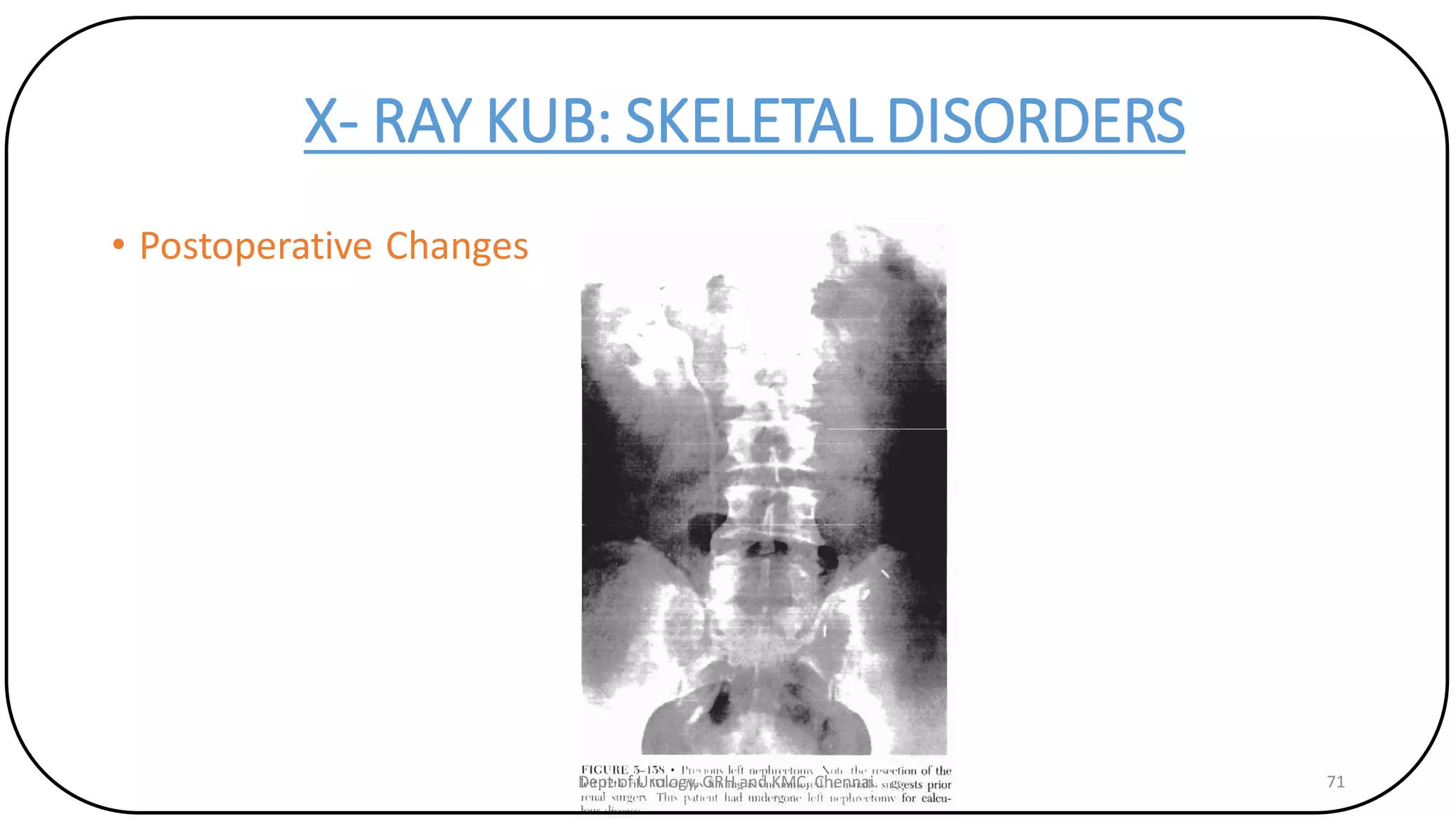 X RAY KUB 2 | PDF