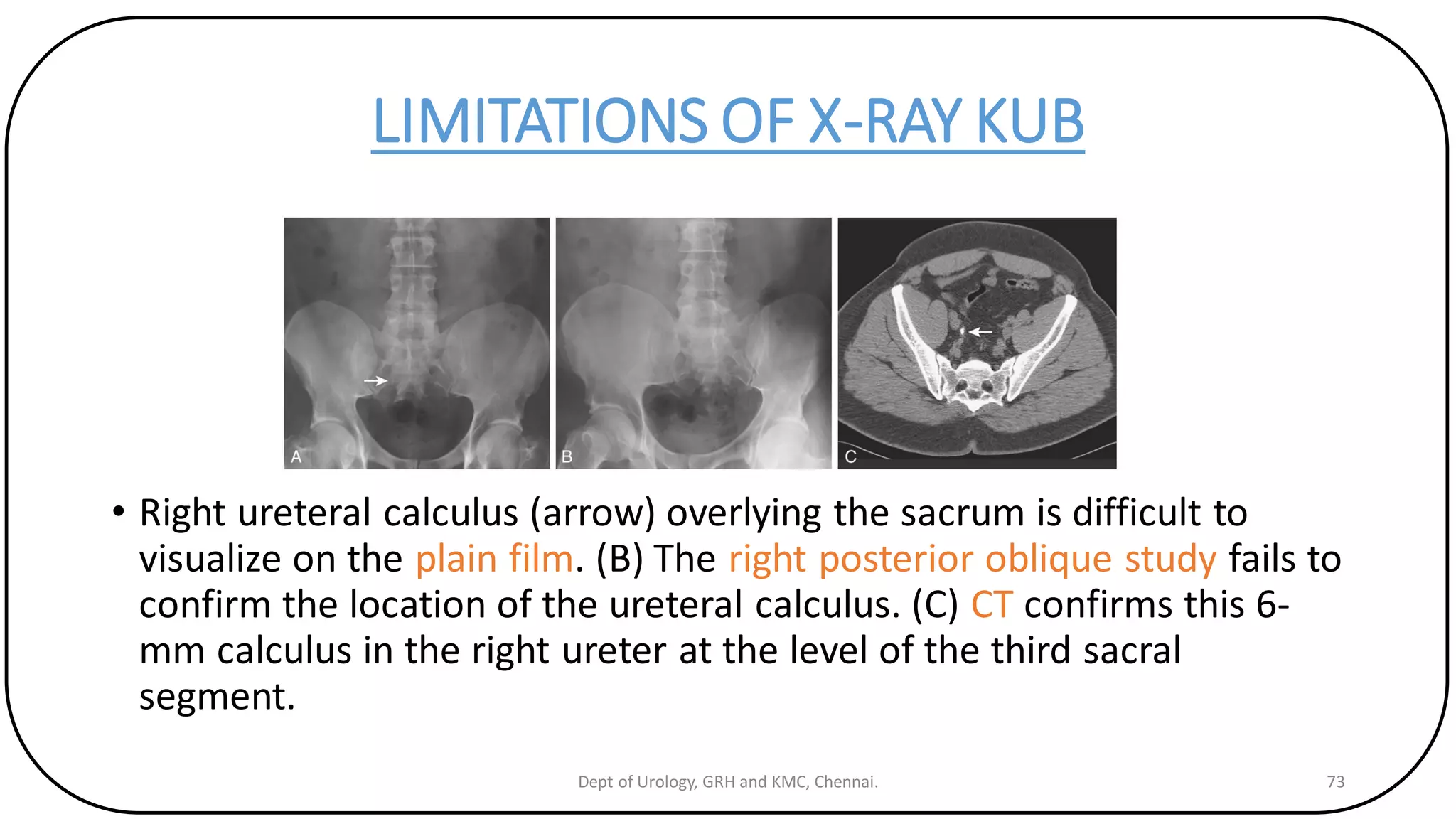 X RAY KUB 2 | PDF