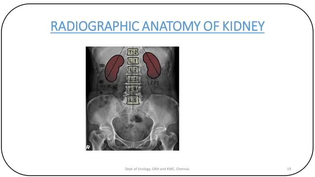X RAY KUB 2 | PDF